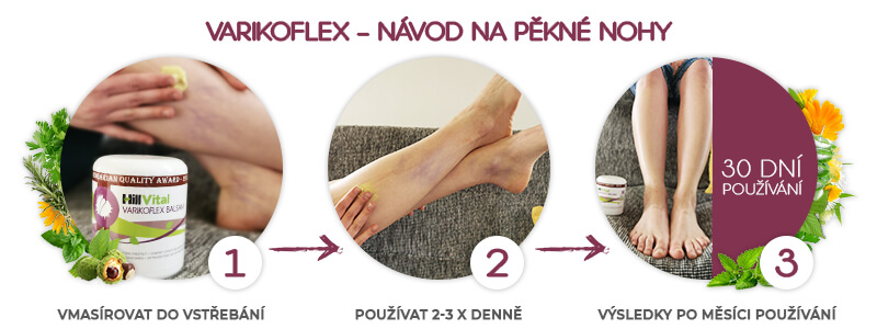 Mast na křečové žíly - Varikoflex | HillVital