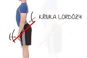 Lordóza - hyperlordóza | HillVital